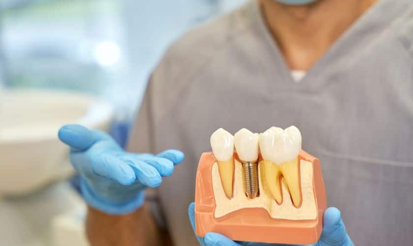 Advantages of Same-Day Dental Implants Over Traditional Procedures